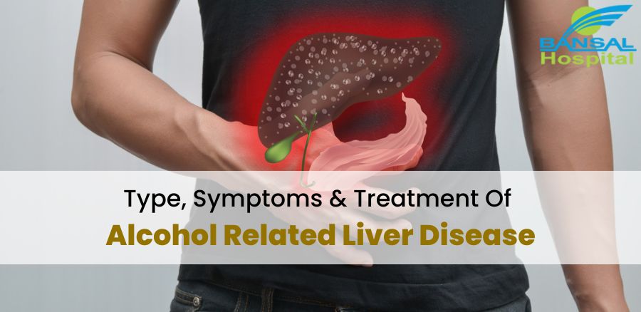 Types, Symptoms and Treatment Of Alcohol Related Liver Disease | Bansal ...